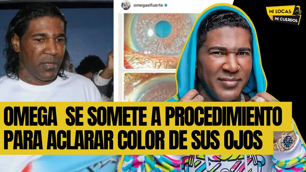 OMEGA SE SOMETE A PROCEDIMIENTO PARA ACLARAR COLOR DE SUS OJOS - YouTube