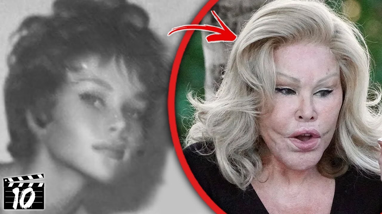 Top 10 Celebrities With Botched Plastic Surgeries - YouTube