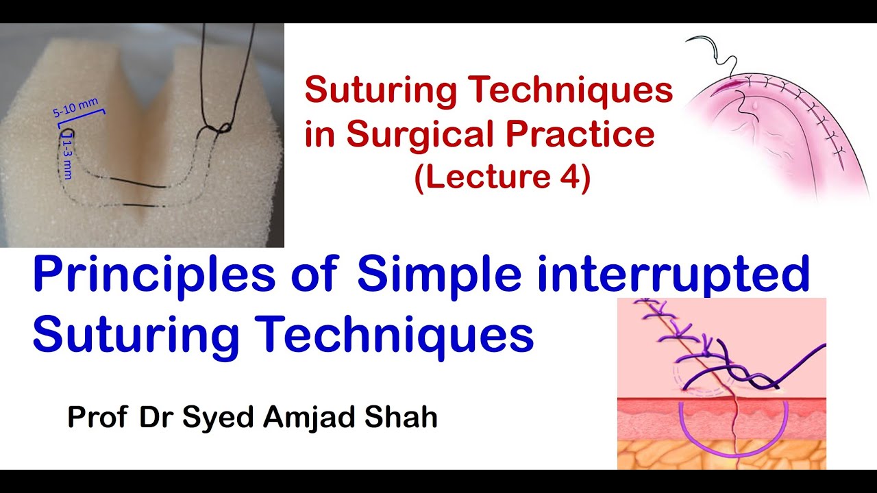 Principles of Simple interrupted Suturing Techniques | Oral ...