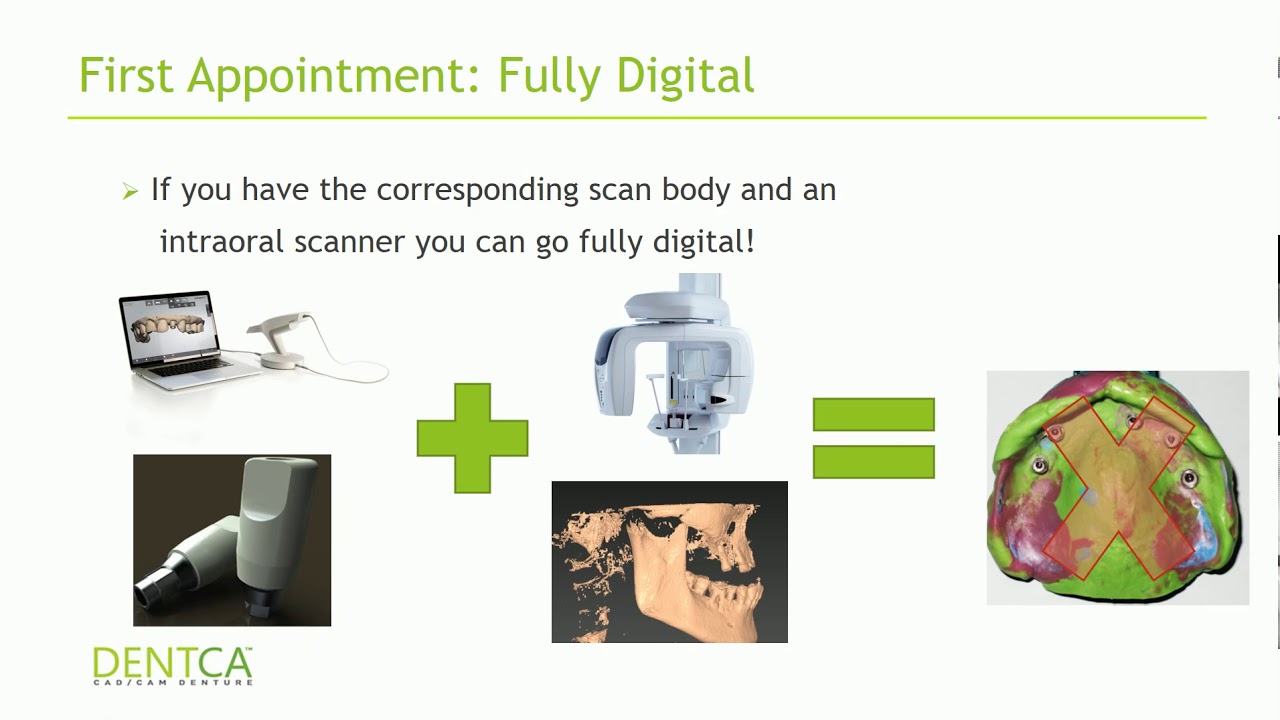 Dentca 4 webinar 2 0 - YouTube