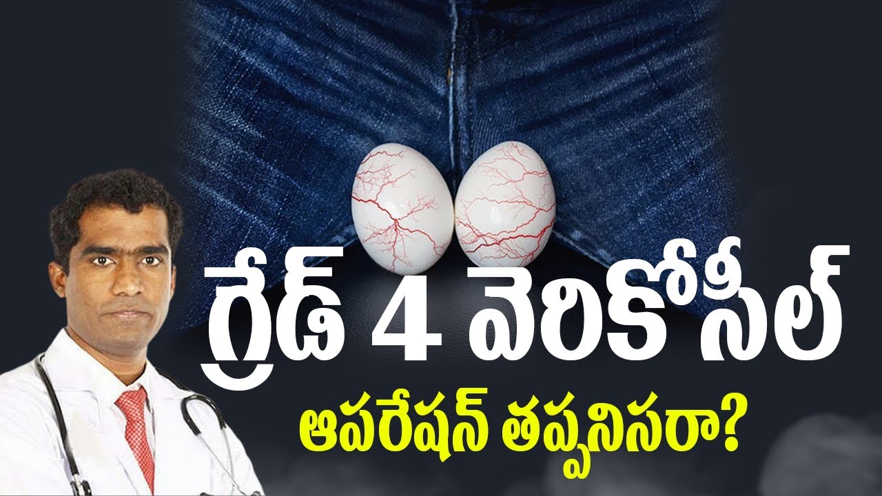 గ్రేడ్ 4 వెరికోసీల్: ఆపరేషన్ తప్పనిసరా? Grade 4 Varicocele Treatment. # ...