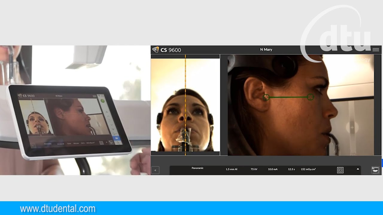 Carestream CS 9600 AI powered Positioning - YouTube