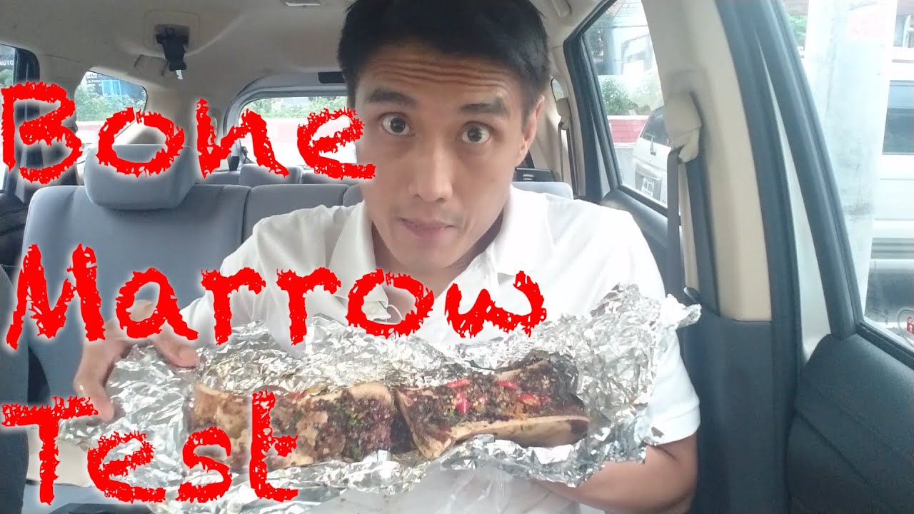 Test to find out if this is a bone marrow match! Pares? Eating food car ...