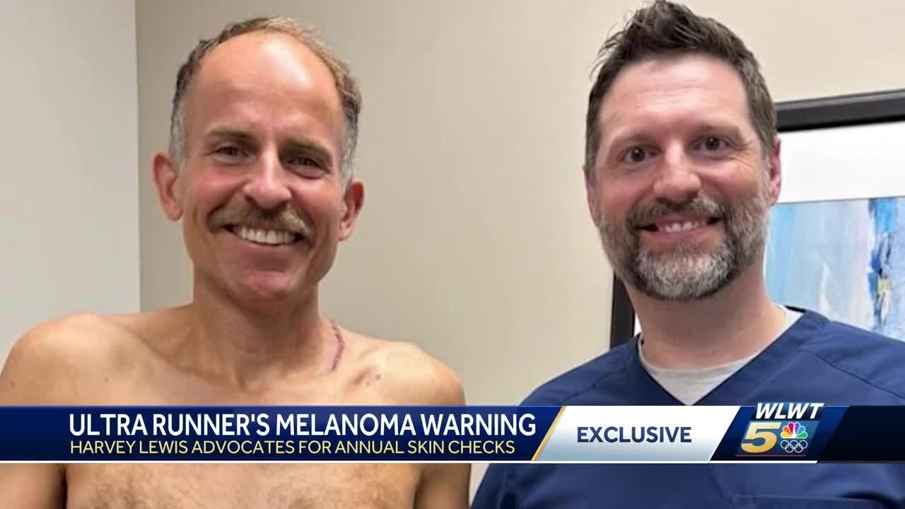 Melanoma warning: Cincinnati ultra-marathoner advocates for annual skin ...