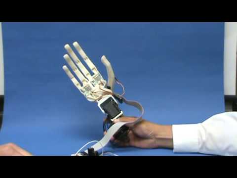 Mano Robotica 2 Alex - YouTube
