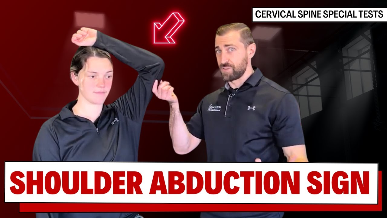 Shoulder Abduction Relief Sign - Cervical Radiculopathy Clinical ...