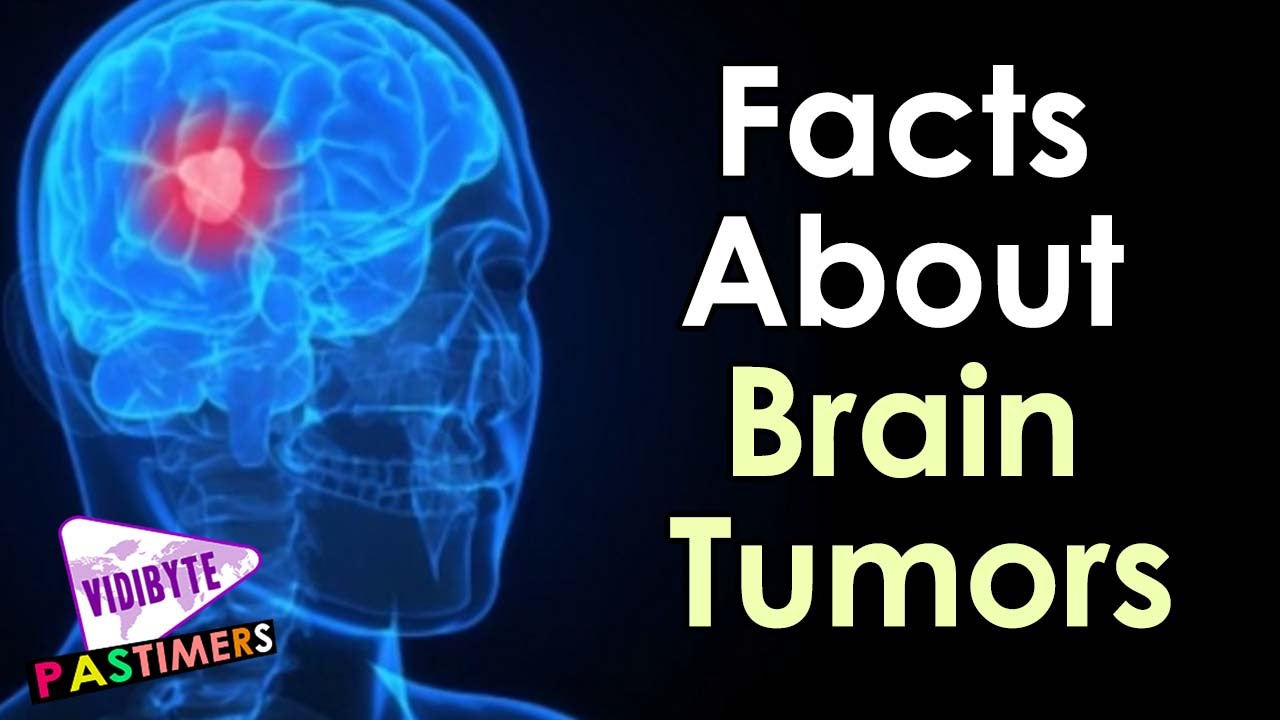 Top Ten Facts About Brain Tumors Health Facts YouTube top-ten-facts-about-brain-tumors-health-facts-youtube