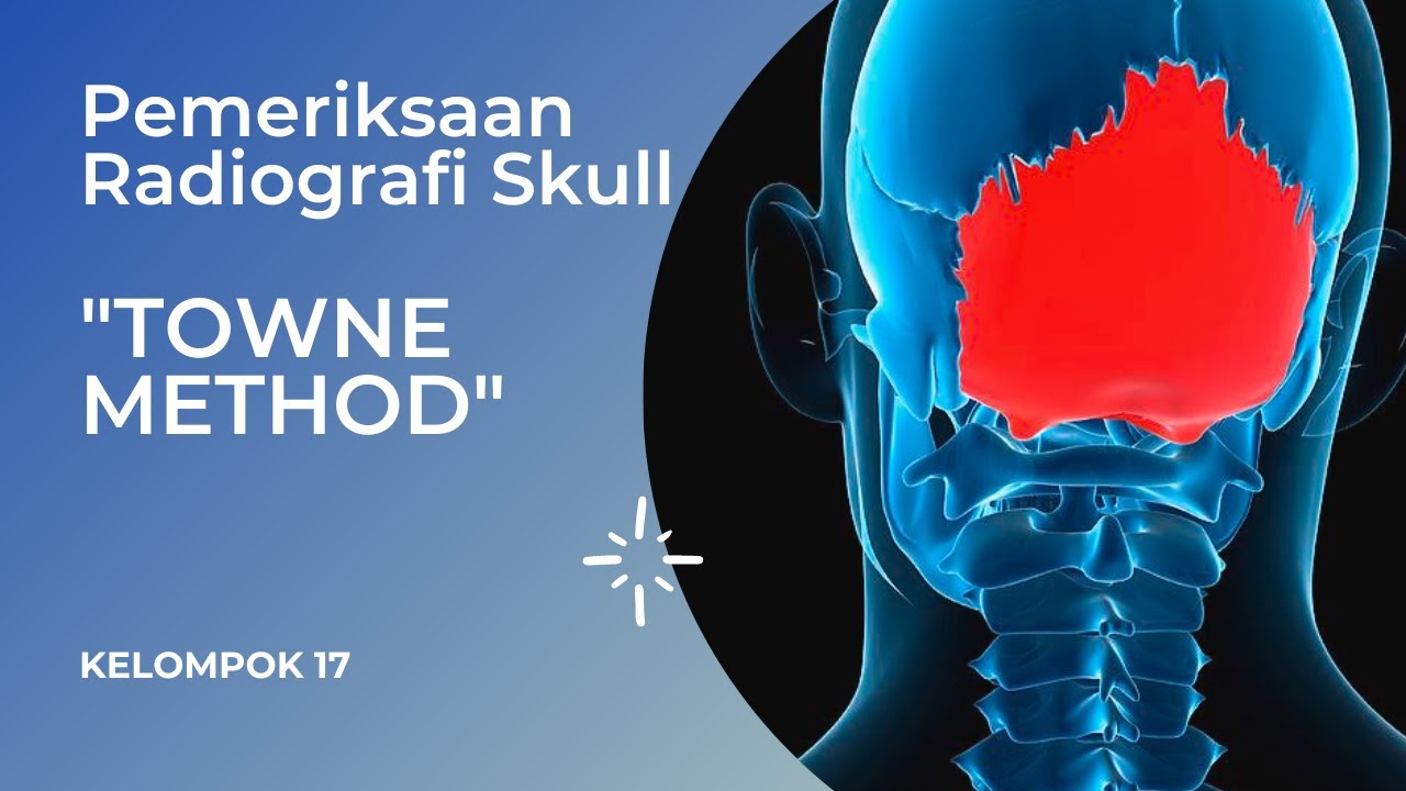 PEMERIKSAAN RADIOGRAFI SKULL "TOWNE METHOD" KELOMPOK 17 - YouTube