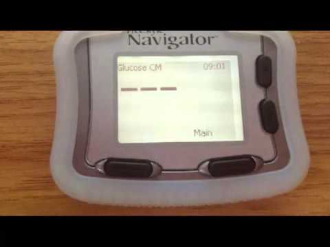 Abbott FreeStyle Navigator CGM Calibration - YouTube
