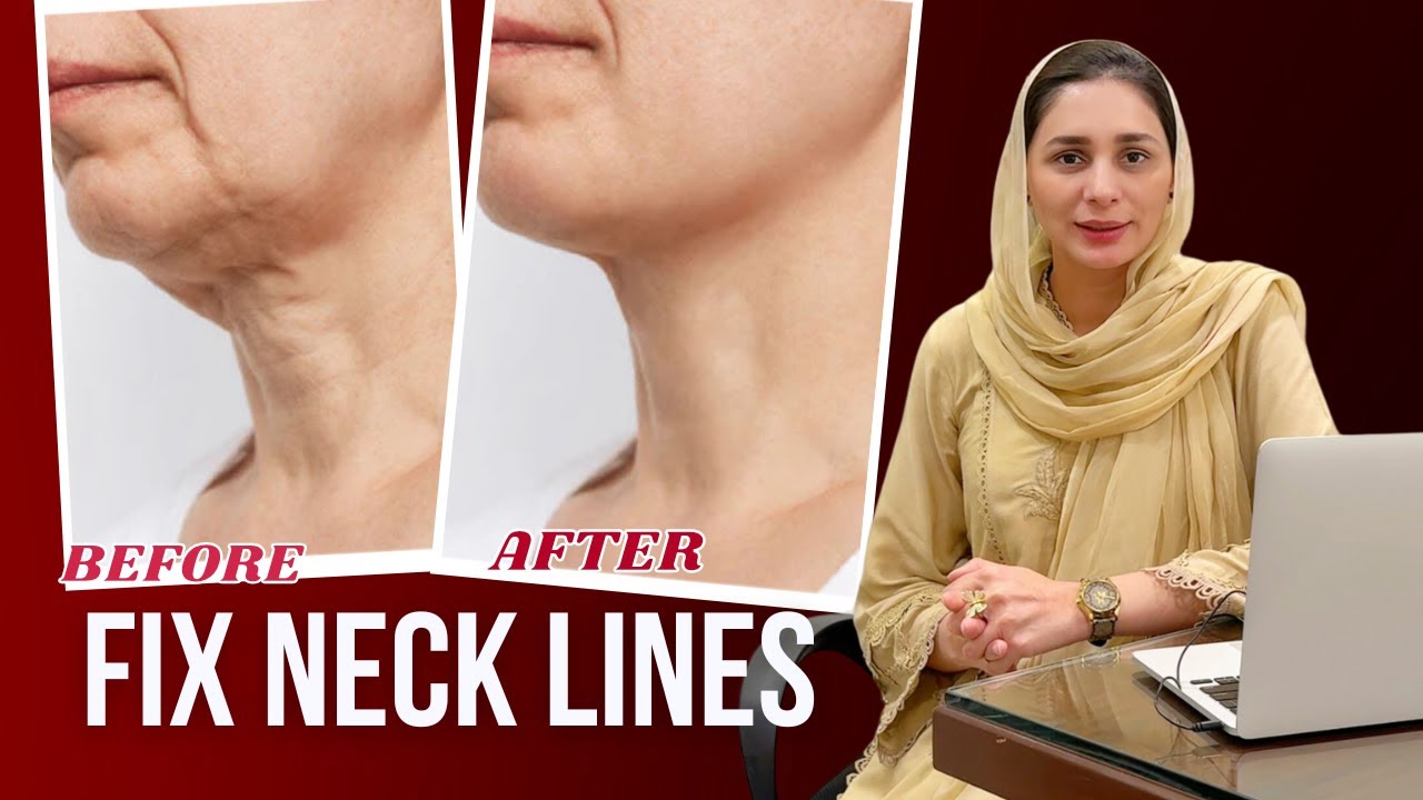How to Make Your Neck Look 10 Yrs Younger | FIX Neck Lines & Wrinkles ...