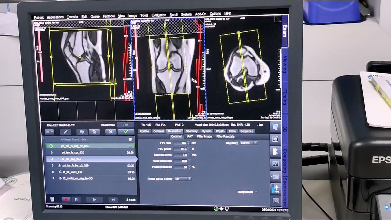 #MRI# #KNEE# How to do MRI Knee planning in MRI-3T in Siemens machine ...