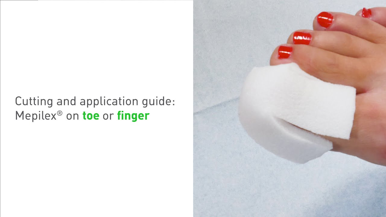 How to apply Mepilex on a toe or a finger - YouTube