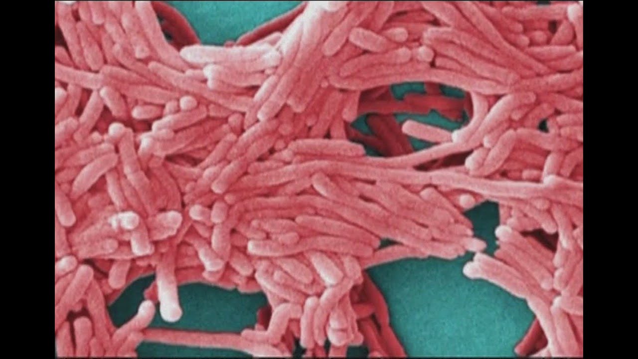 Legionnaire's Disease cluster in the Bronx - YouTube