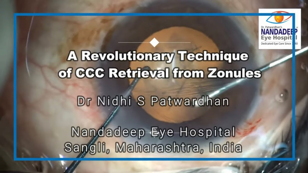 A rescue technique to retrieve radial tear of CCC - YouTube