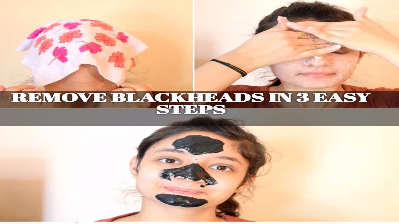 BLACKHEADS TREATMENT/BEST BLACKHEAD REMOVAL PRODUCT/BLACKHEAD REMOVAL ...