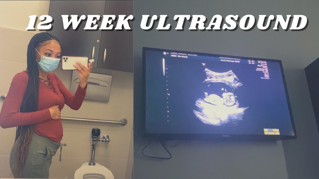 12 WEEKS PREGNANT: ultrasound updates + PLACENTA PREVIA - YouTube