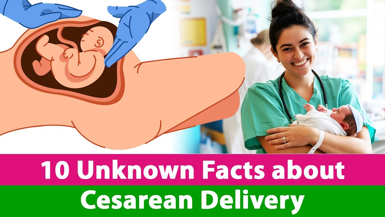 10 unknown facts about Cesarean Delivery #cesareanbirth #baby #babygirl ...