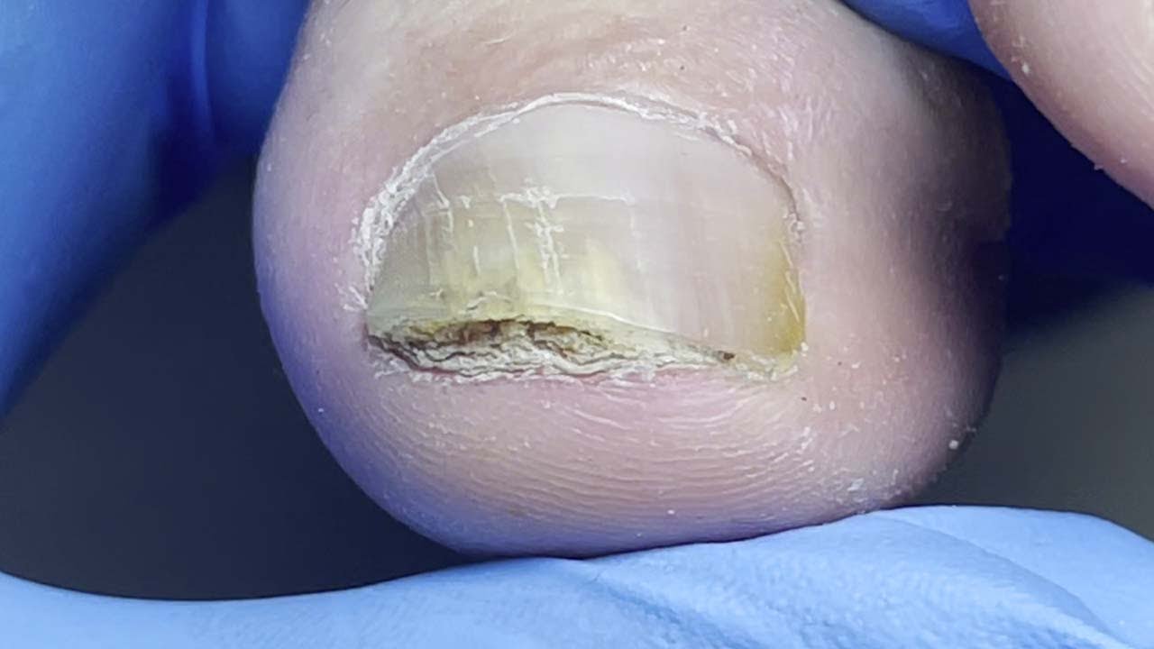 Pedicure Tutorial: The Complete Manicure Process for Thick Nails! - YouTube