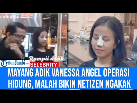 Operasi Hidung, Wajah Mayang Adik Vanessa Angel Malah Bikin Netizen ...