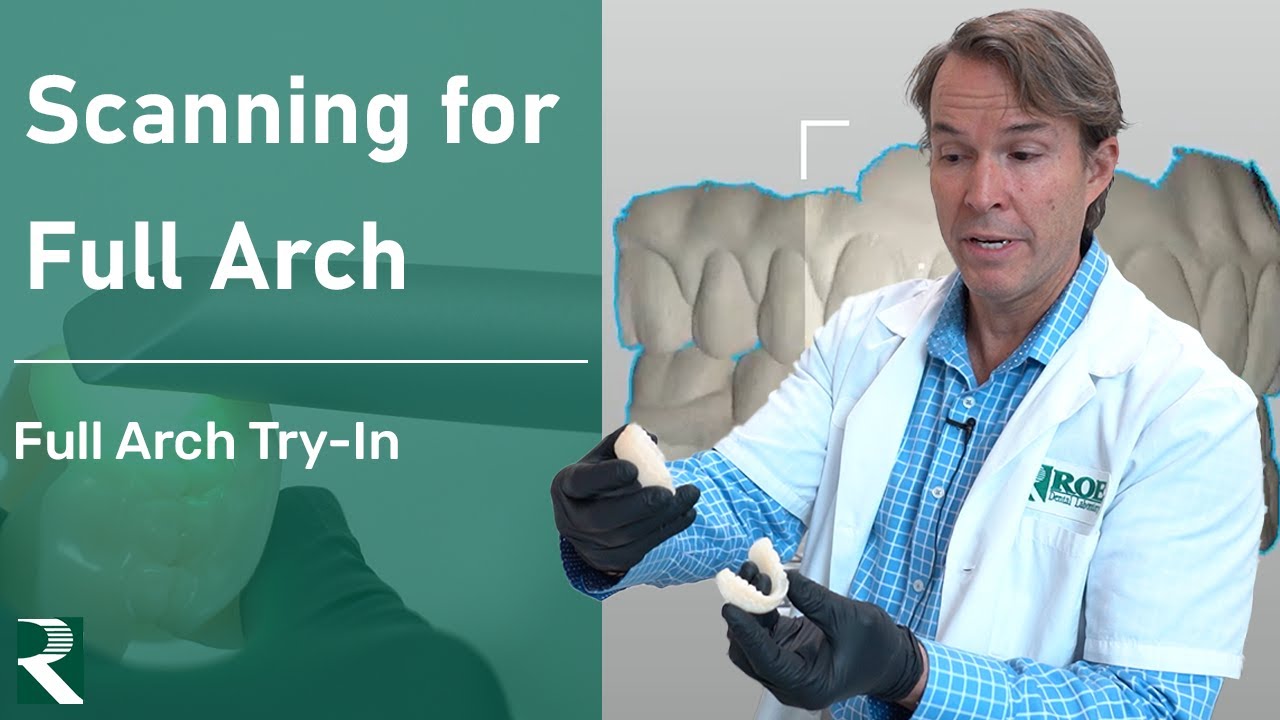 Scanning for Full Arch - Full Arch Try-In - YouTube