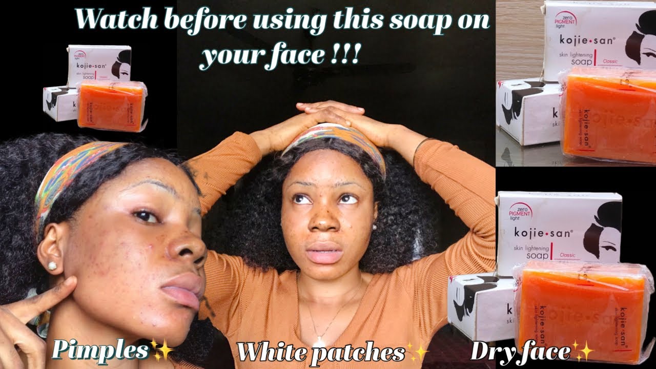 Side effects of Kojie San whitening soap #kojiesan - YouTube
