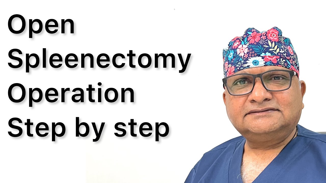 Open Spleenectomy Operation (Spleen Damaged in an Accident) step by ...