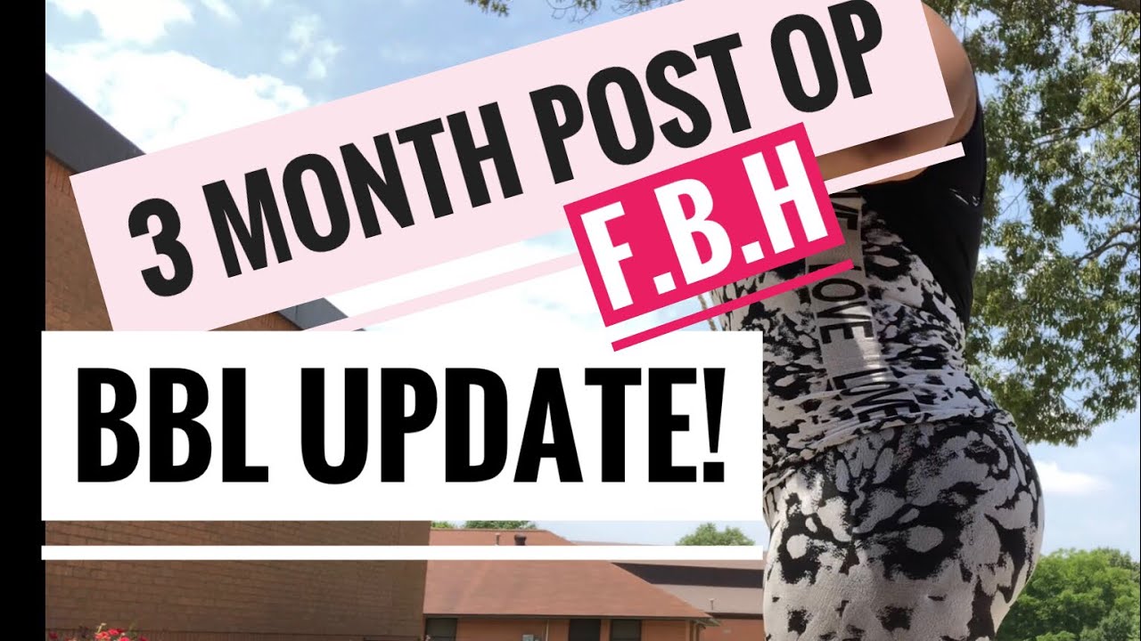 Brazilian Butt Lift (Bbl) | 3 Months Post Op Video - YouTube