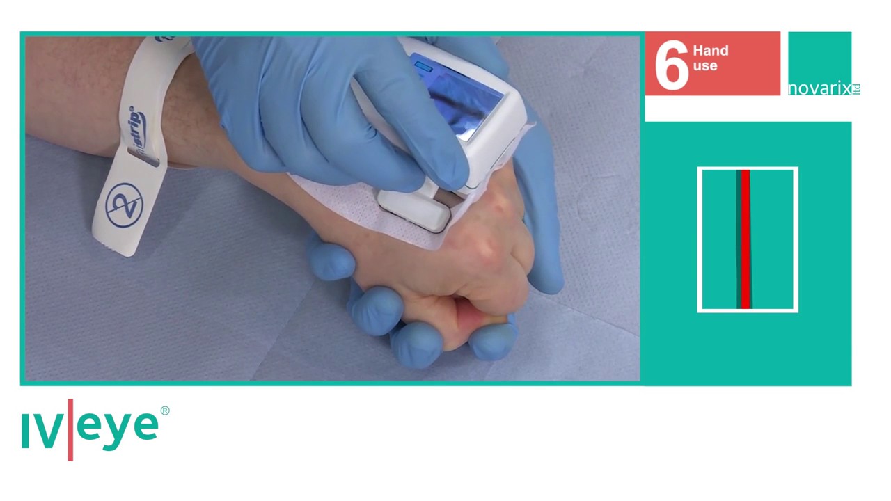 6 Using the IV eye® on the hand - YouTube