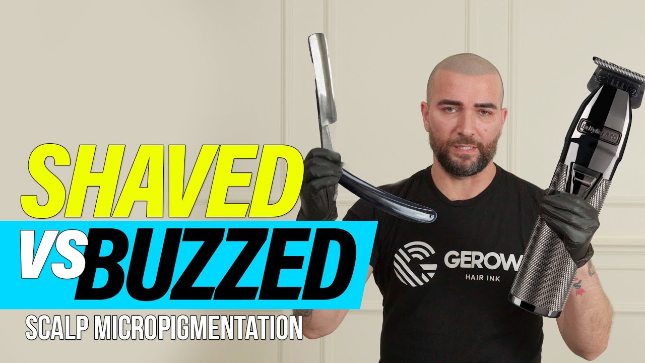 SHAVED VS BUZZED SCALP MICROPIGMENTATION - YouTube