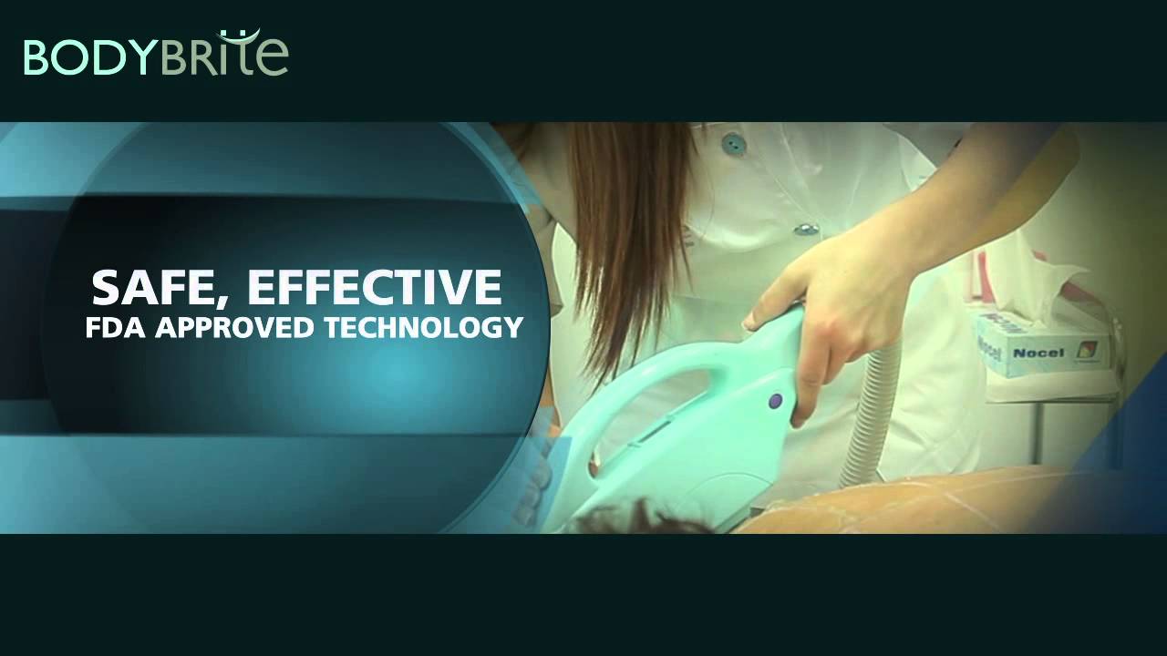 BodyBrite Austin IPL Permanent Hair Removal Treatments - YouTube