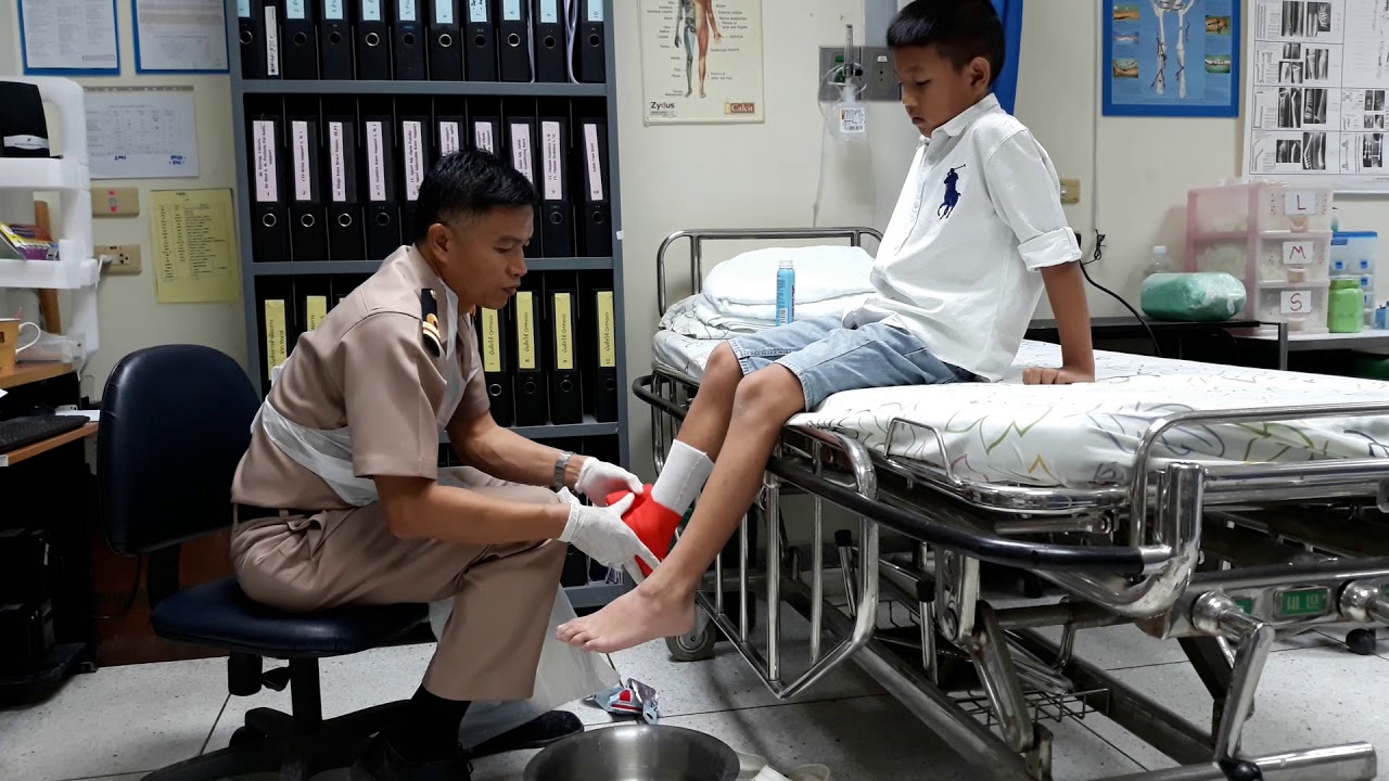 Title on functional cast for ankle spain - YouTube