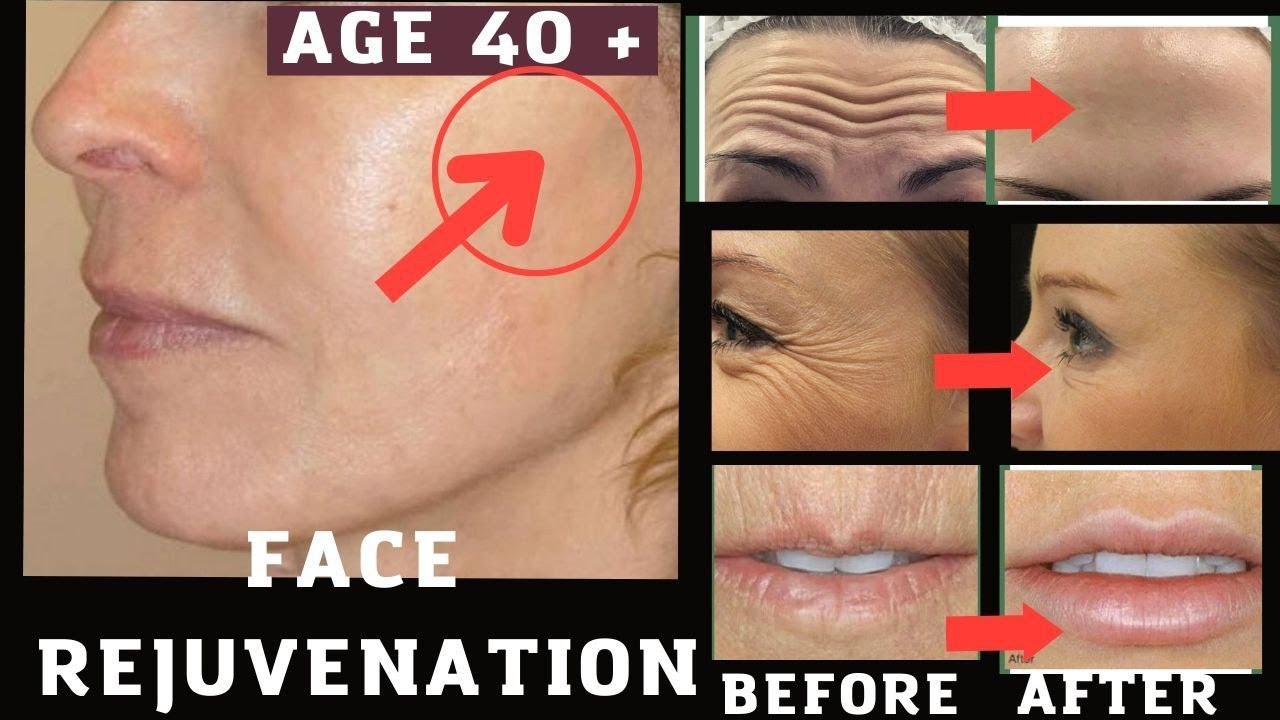 Age 40+| Face Rejuvenation | Reverse Aging, Fix Face Wrinkles|Lift ...