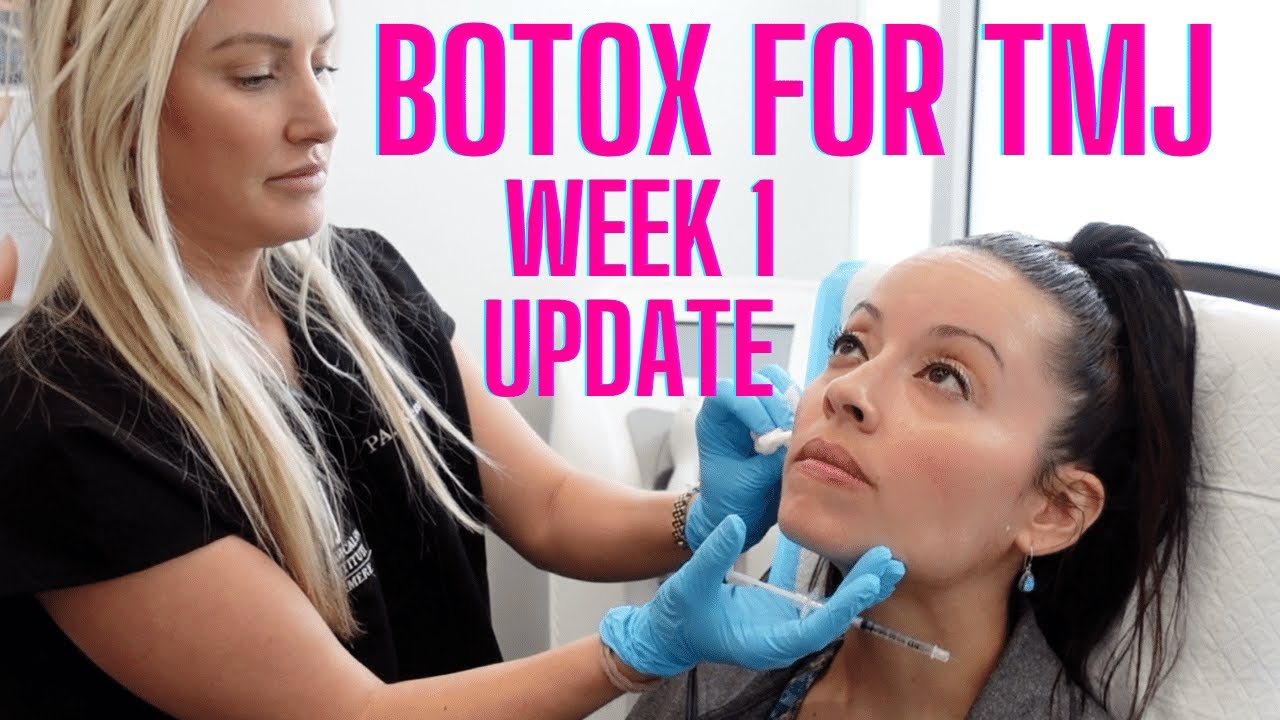 BOTOX for TMJ Week 1 Update - YouTube