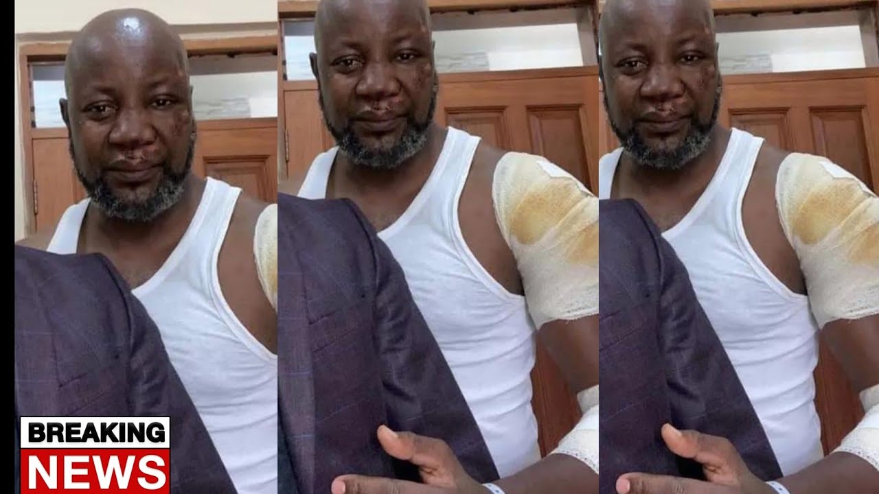 Samson kasumba/ Nbs tv/ news anchor serves nasty accident pray for him ...