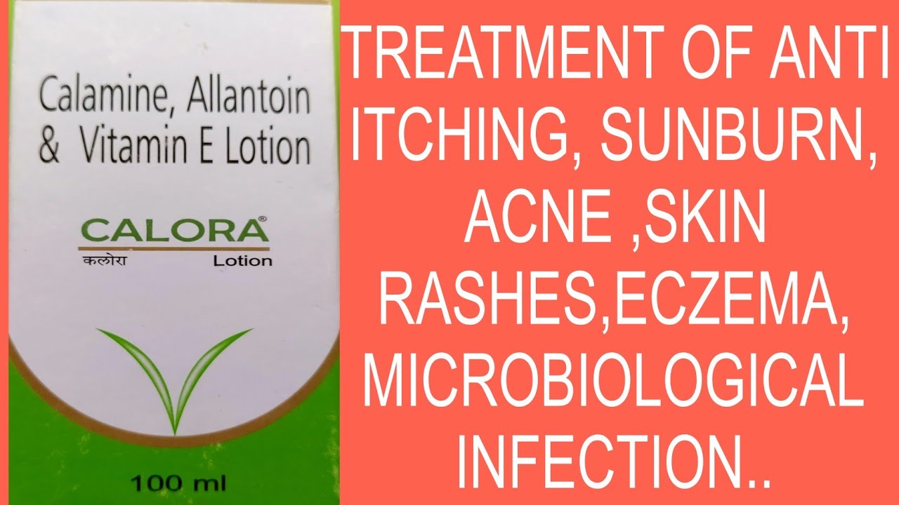 ###CALORA LOTION # MODE OF ACTION # DOSES & SIDE-EFFECTS # - YouTube