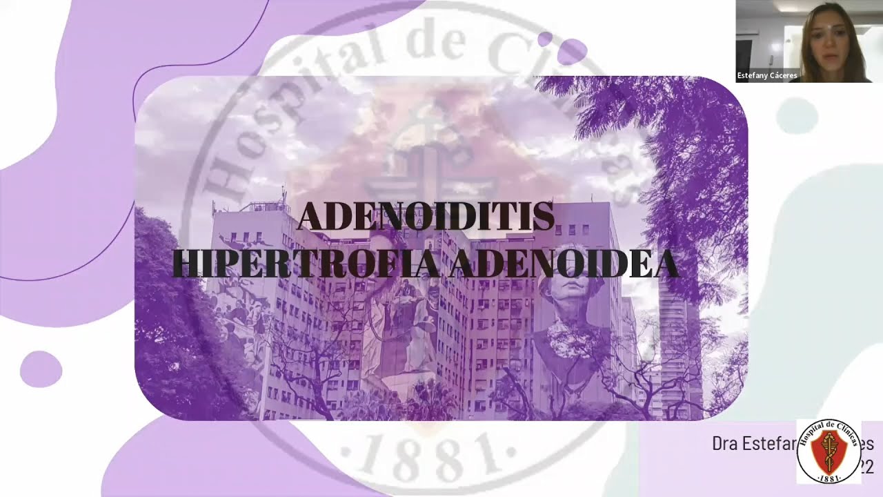 21/06/2022 - Adenoiditis. Hipertrofia adenoidea. - YouTube