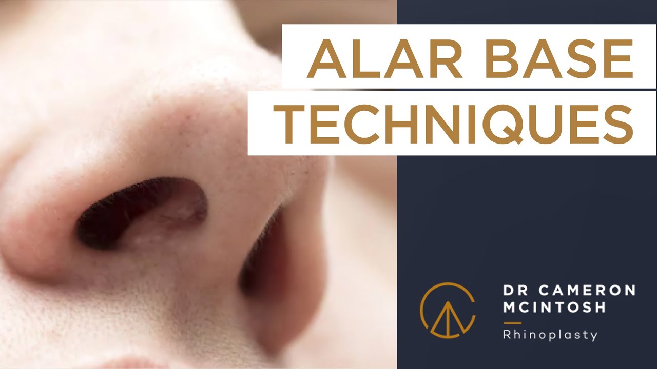 Alar Base Techniques | Dr Cameron McIntosh - YouTube
