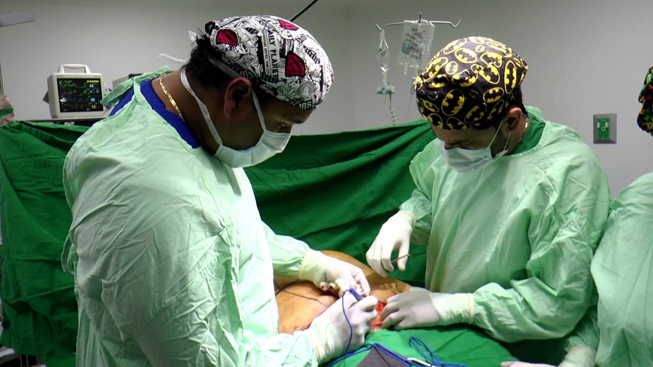 Ronald Ramos Lipectomía Circunferencial - YouTube