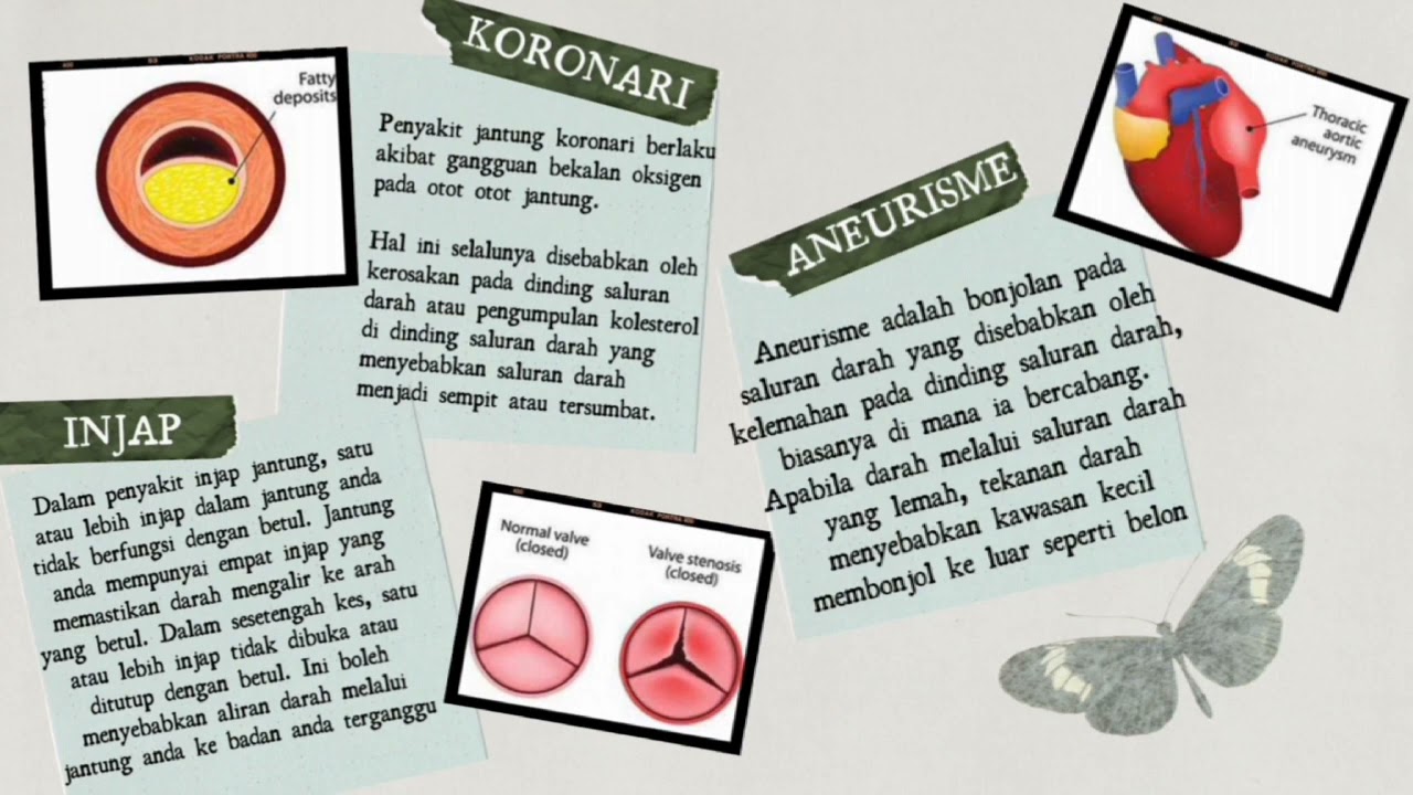 Tingkatan 3 Sains Kesihatan Jantung 308@SMKDB - YouTube