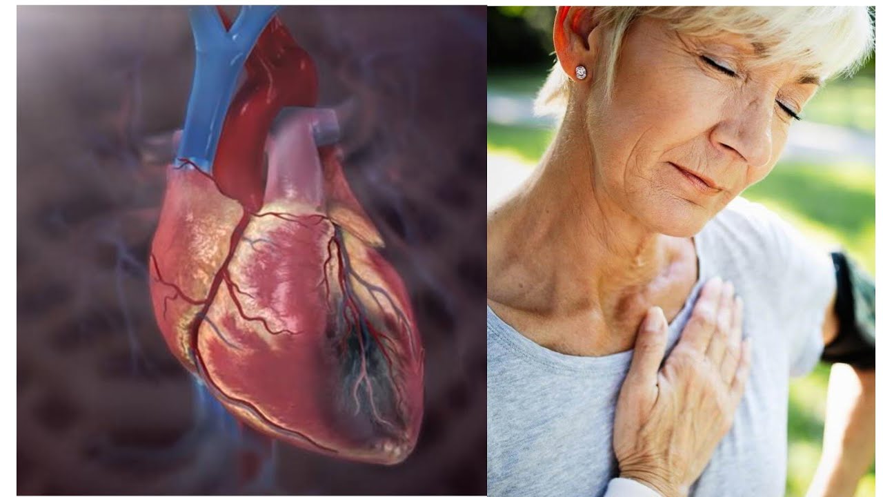 CLINICAL MANIFESTATIONS OF HEART IMBALANCES - YouTube