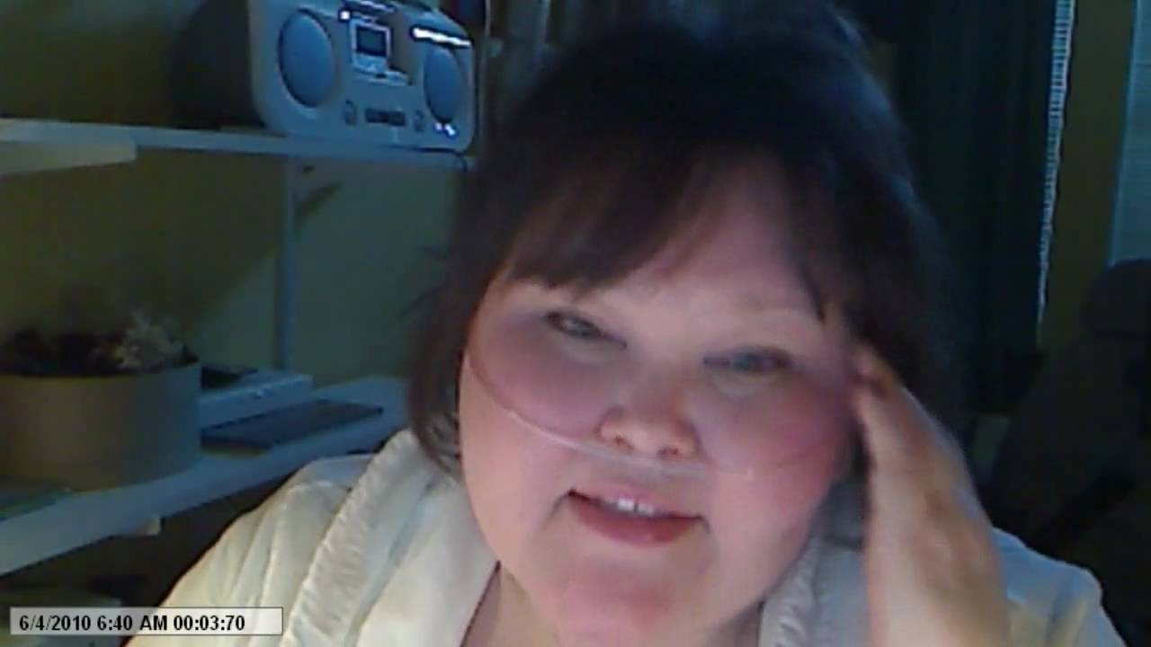 Lupus 6-4-10 Part 4 Recovery from Sepsis and Optic Neuritis - YouTube