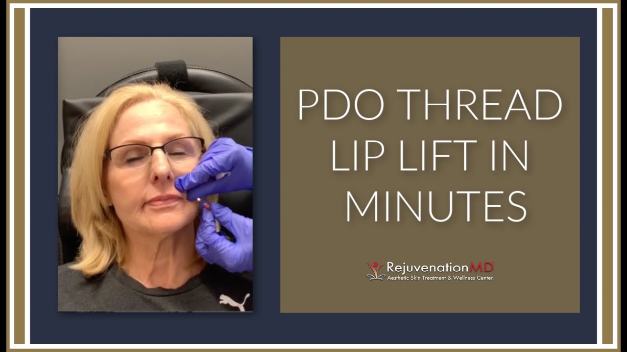 Why Do A PDO Lip Lift? - YouTube