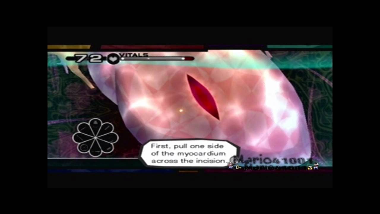 Trauma Team - CR-S01 Story - 2 - Operation - YouTube