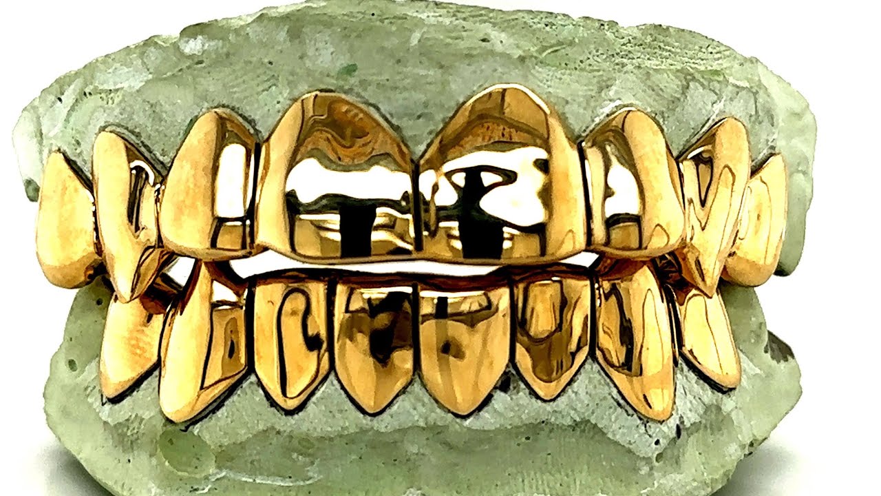 Buy custom gold grills globally at seattle gold grills. - YouTube