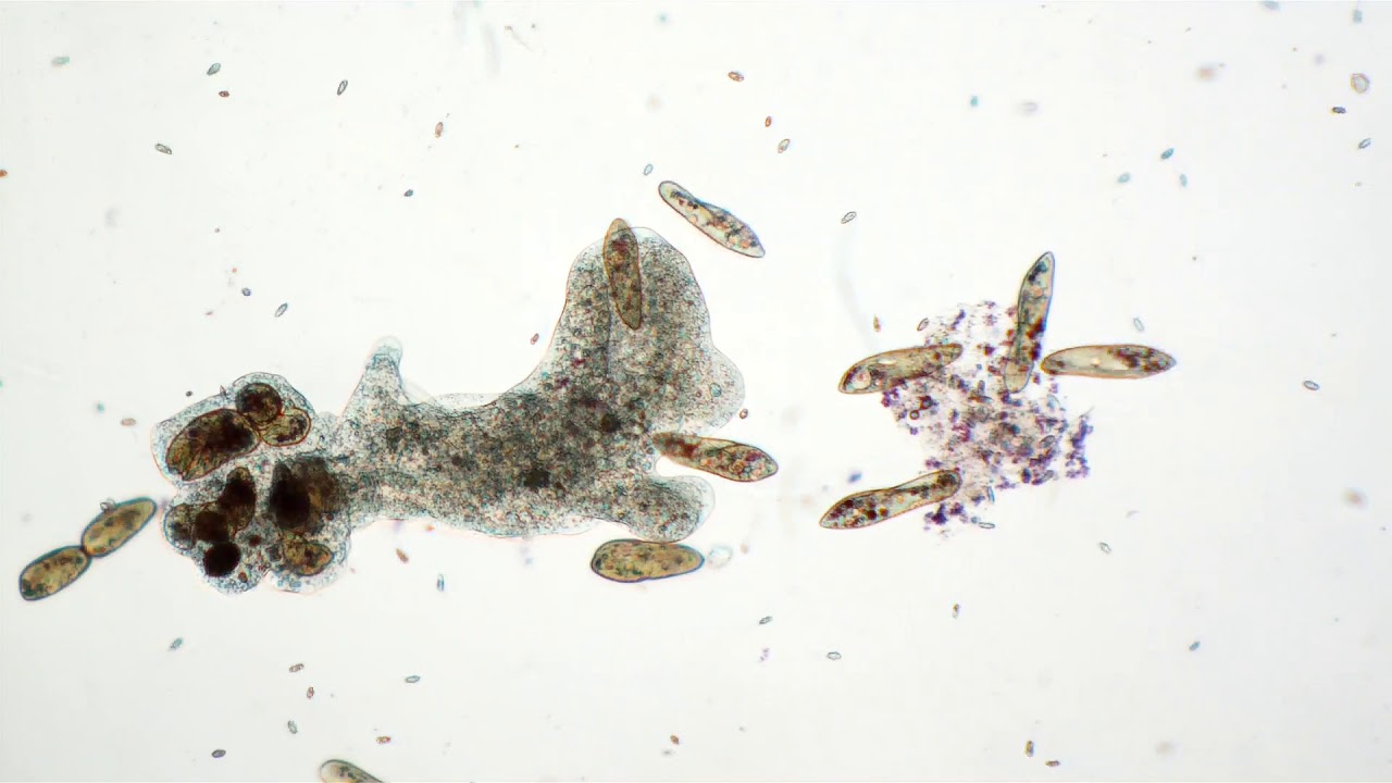 Amoeba 100x Magnification