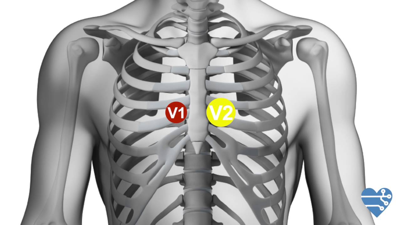 VIDEOTUTORIAL - Cardiopad Pro - YouTube