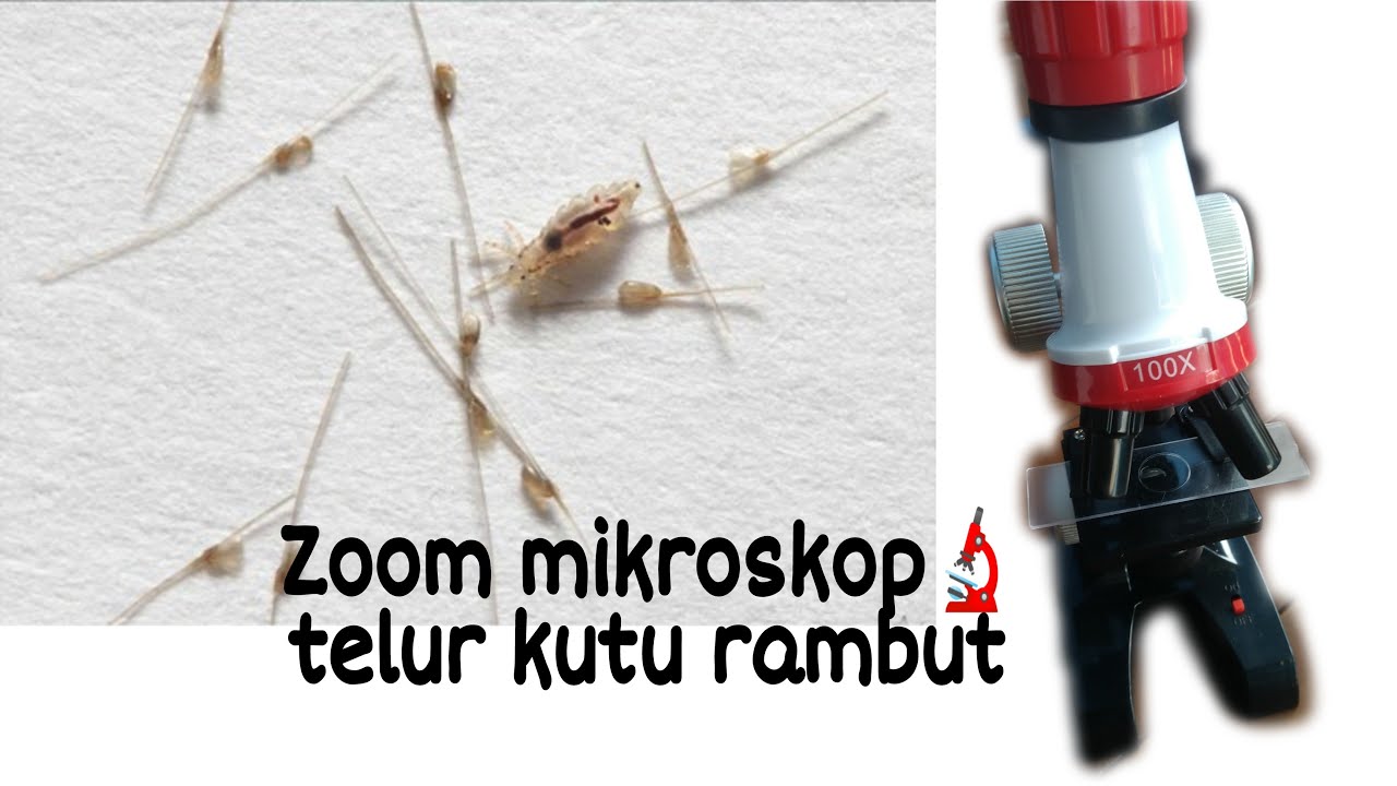 Zoom mikroskop Telur Kutu Rambut - YouTube