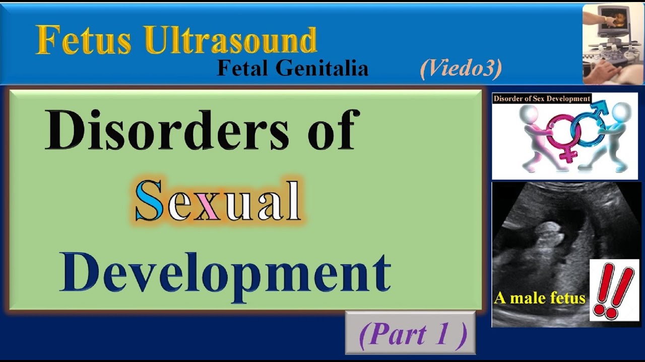 Fetus Ultrasound Disorders Of Sexual Development Part1 Youtube