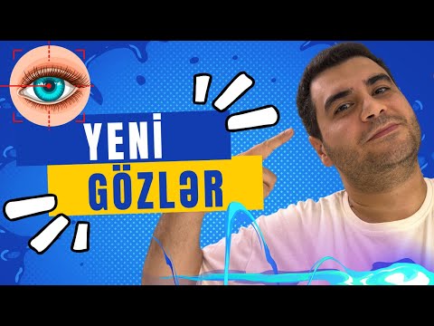 Göz lazer əməliyyatı etdim. Peşman oldum?