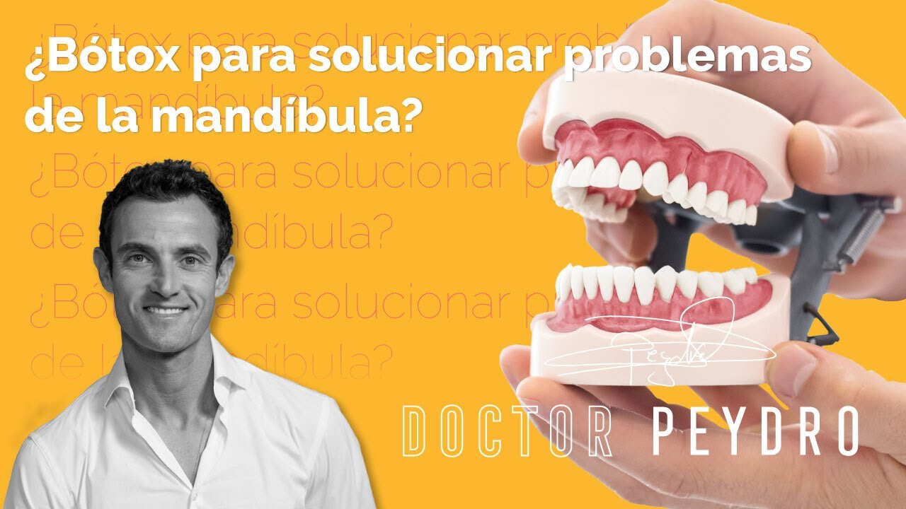 ¿Funciona el bótox para solucionar problemas de la mandíbula? - YouTube